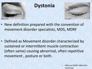Dystonia and movement disorder | PPT