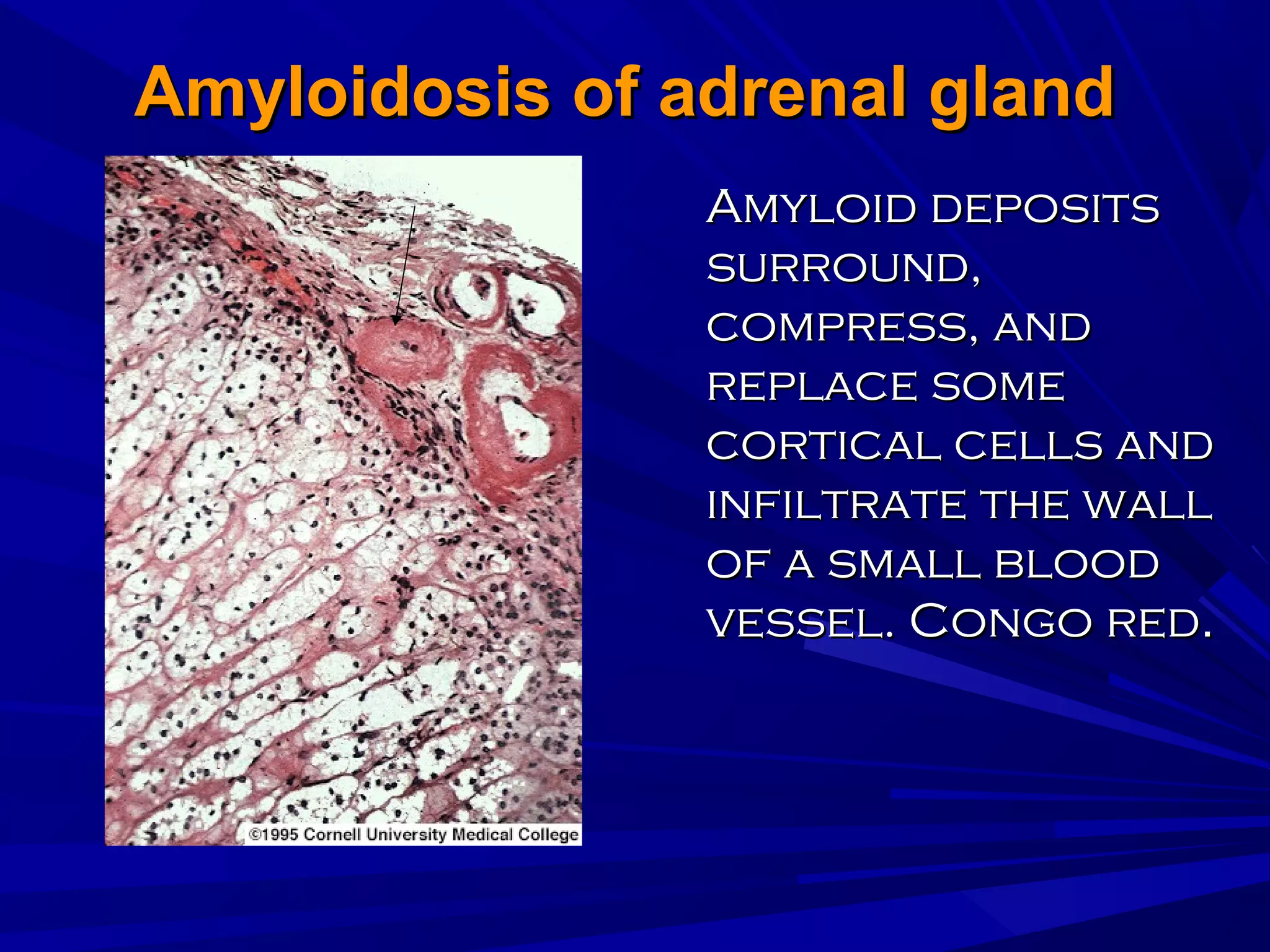 Dystrophy | PPT