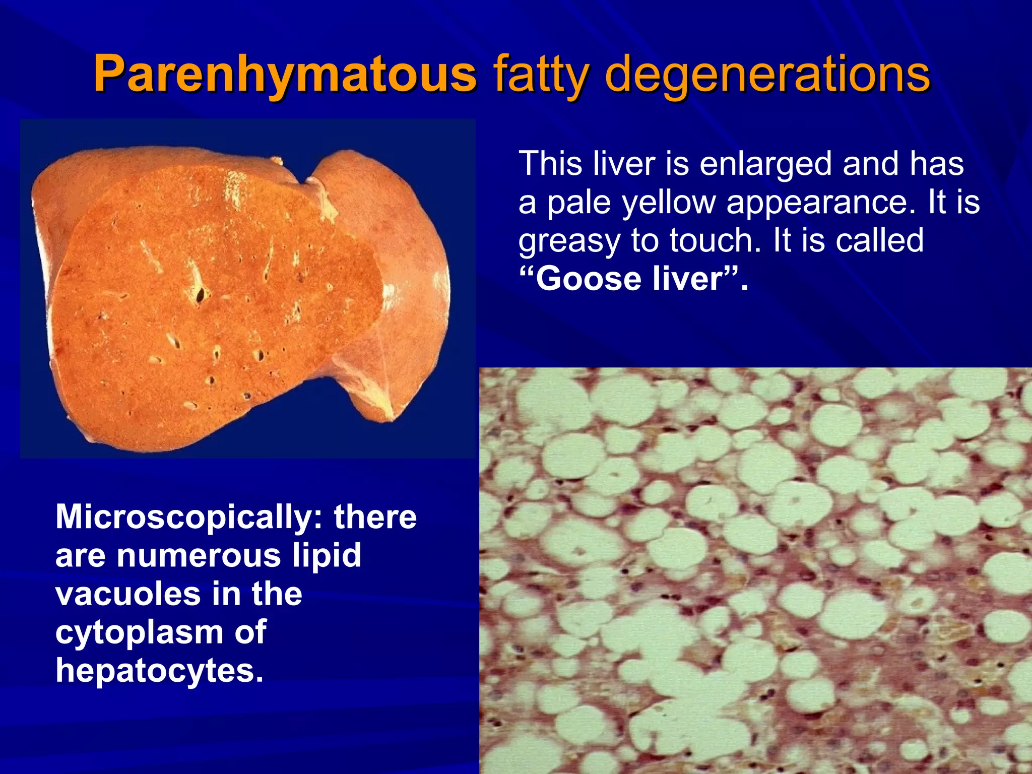 Dystrophy | PPT