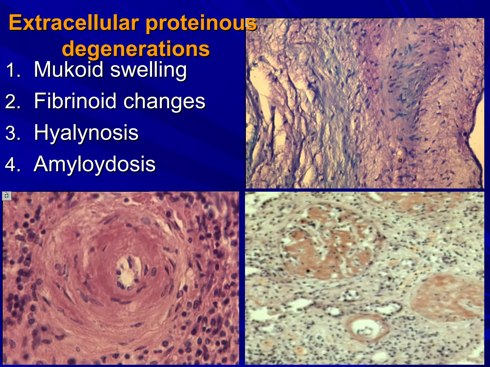 Dystrophy | PPT | Biological Sciences | Science