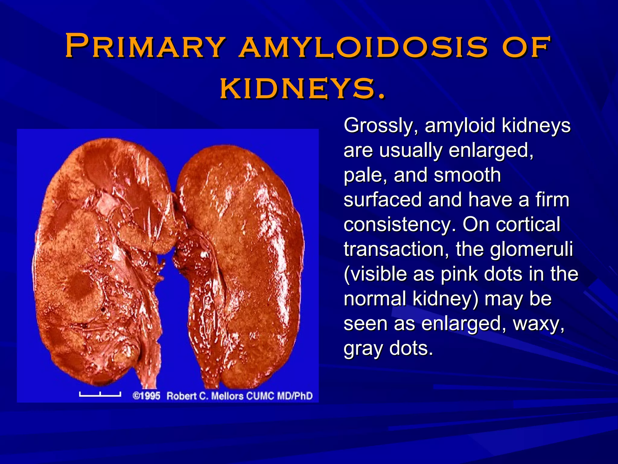 Dystrophy | PPT | Biological Sciences | Science