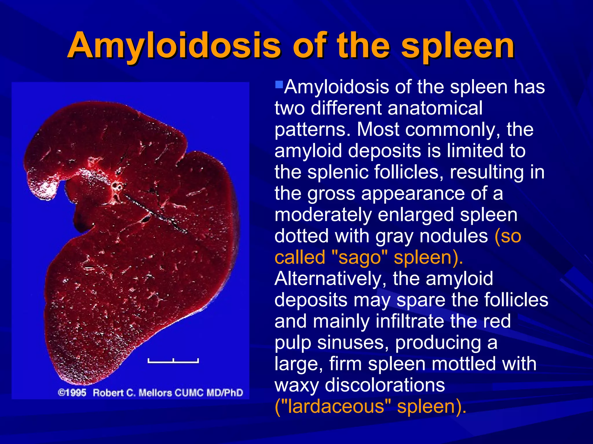 Dystrophy | PPT | Biological Sciences | Science