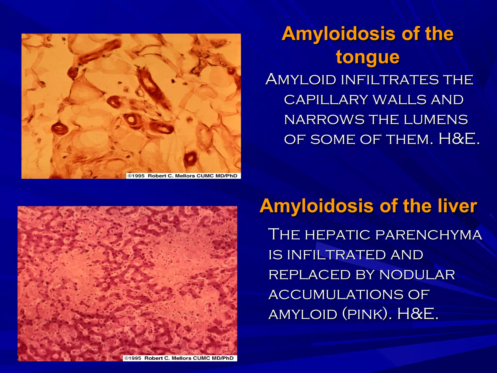 Dystrophy | PPT | Biological Sciences | Science
