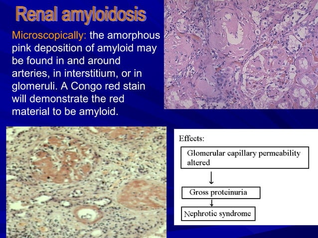 Dystrophy | PPT | Biological Sciences | Science