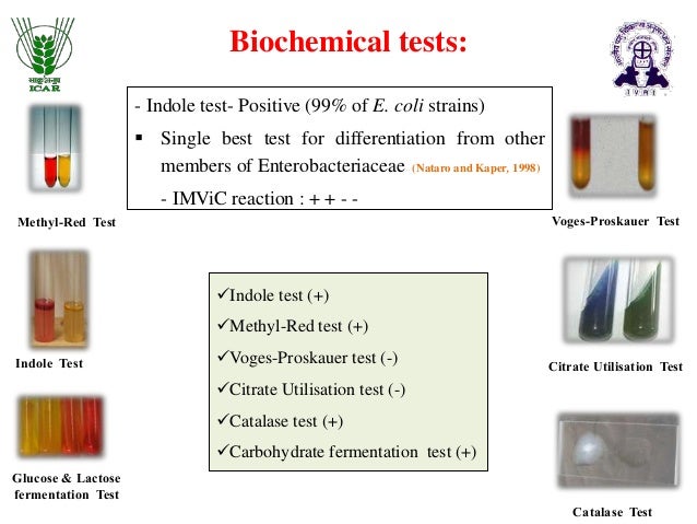Understanding Colloquial laboratory workhorse: Escherichia coli