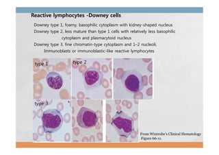 E-2. ÀÌÁ¤³à_Atlas of lymphocyte.pdf | Blood Disorders | Diseases and ...
