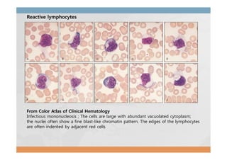 E-2. ÀÌÁ¤³à_Atlas of lymphocyte.pdf