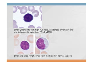 E-2. ÀÌÁ¤³à_Atlas of lymphocyte.pdf