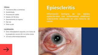 Escleritis Ocular Que Es Causas Sintomas Y Tratamiento – HHCT