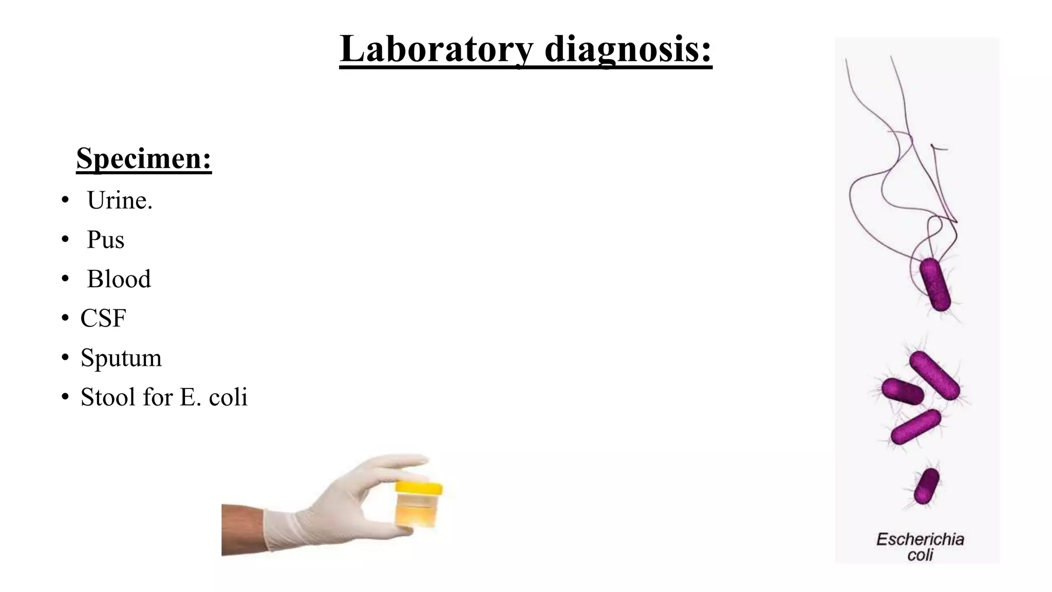 E.coli and klebsiella | PPTX