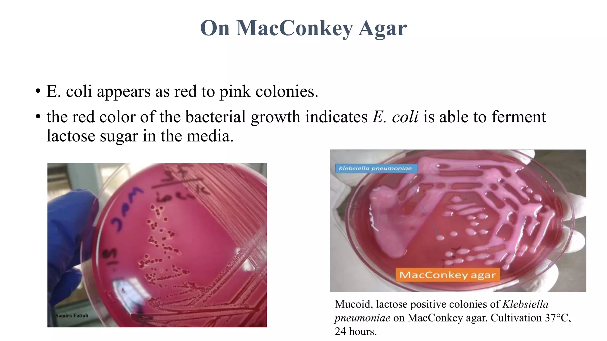 E.coli and klebsiella | PPTX