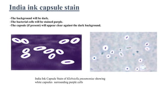 E.coli and klebsiella | PPTX
