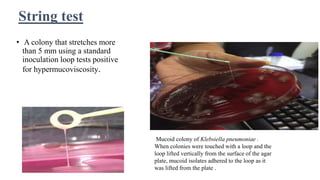 E.coli and klebsiella | PPTX