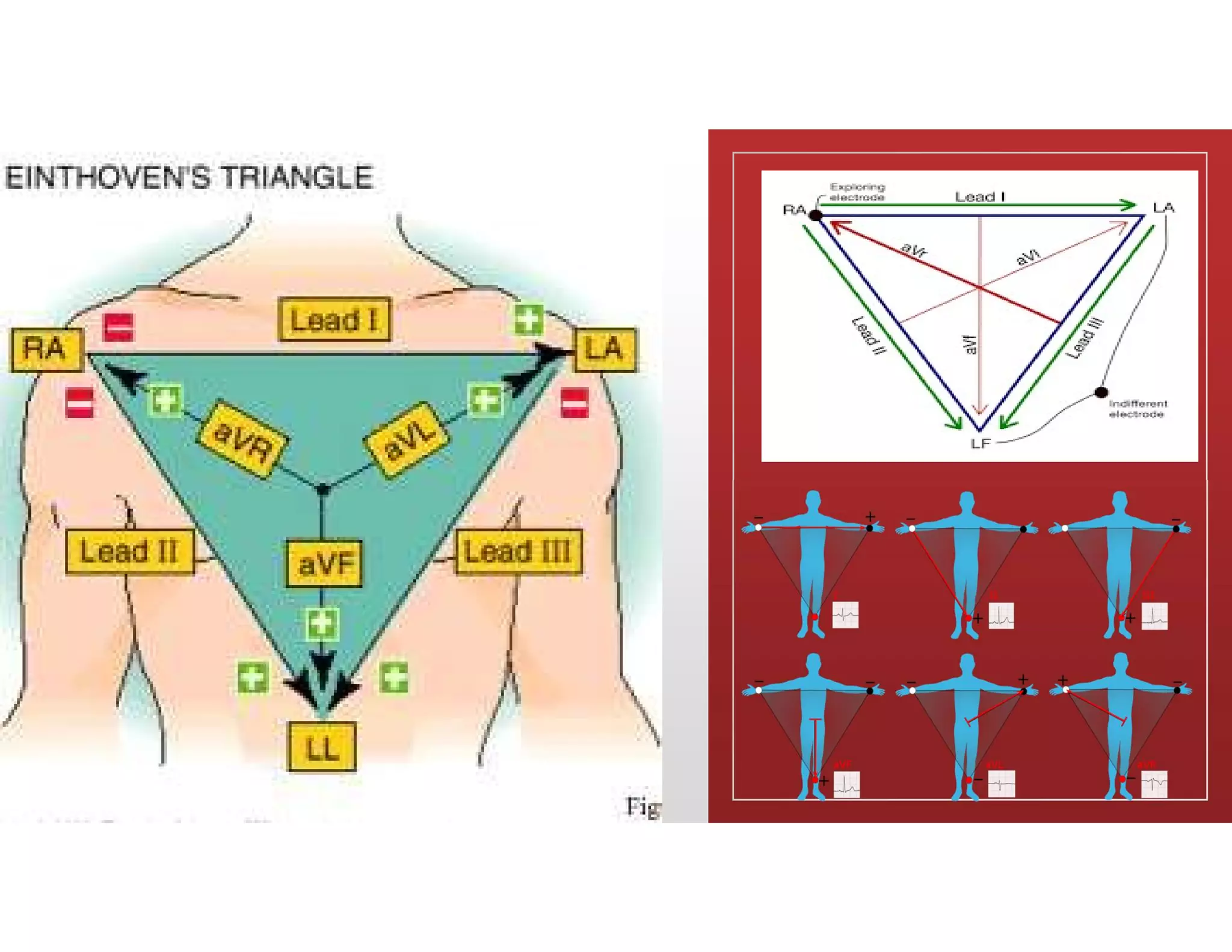 E.C.G. UNDERSTANDING AND INTERPRETATION | PDF