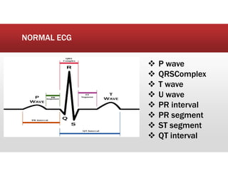 E.C.G. UNDERSTANDING AND INTERPRETATION | PDF