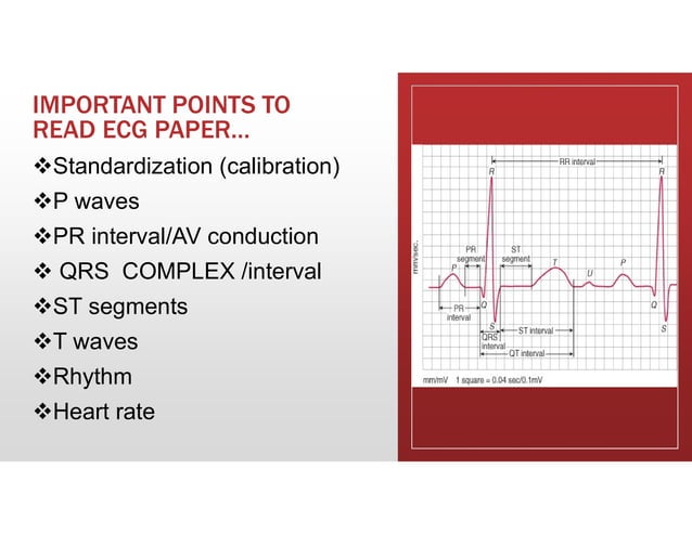 E.C.G. UNDERSTANDING AND INTERPRETATION | PDF