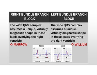 E.C.G. UNDERSTANDING AND INTERPRETATION | PDF