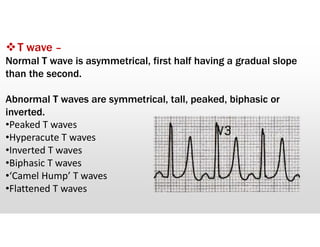 E.C.G. UNDERSTANDING AND INTERPRETATION | PDF