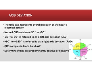 E.C.G. UNDERSTANDING AND INTERPRETATION | PDF