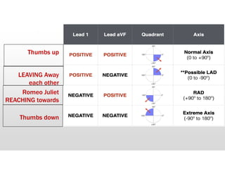 E.C.G. UNDERSTANDING AND INTERPRETATION | PDF