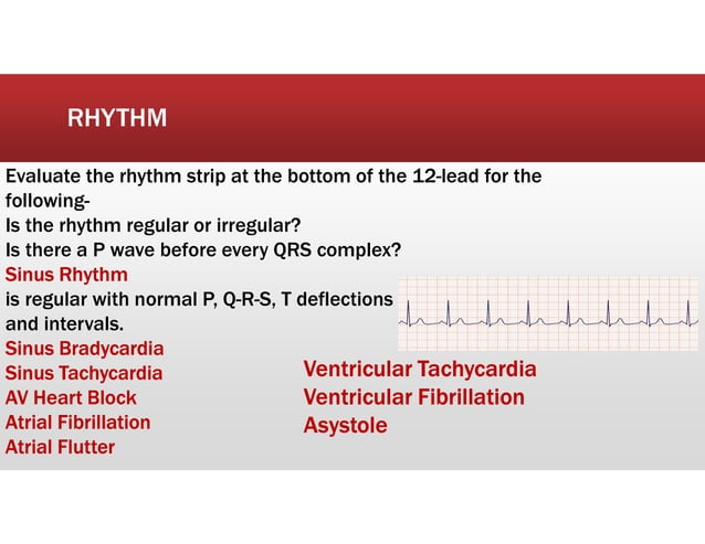 E.C.G. UNDERSTANDING AND INTERPRETATION | PDF