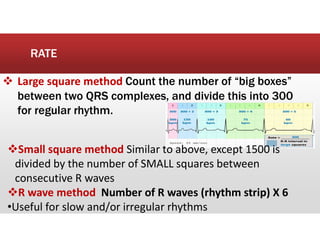 E.C.G. UNDERSTANDING AND INTERPRETATION | PDF