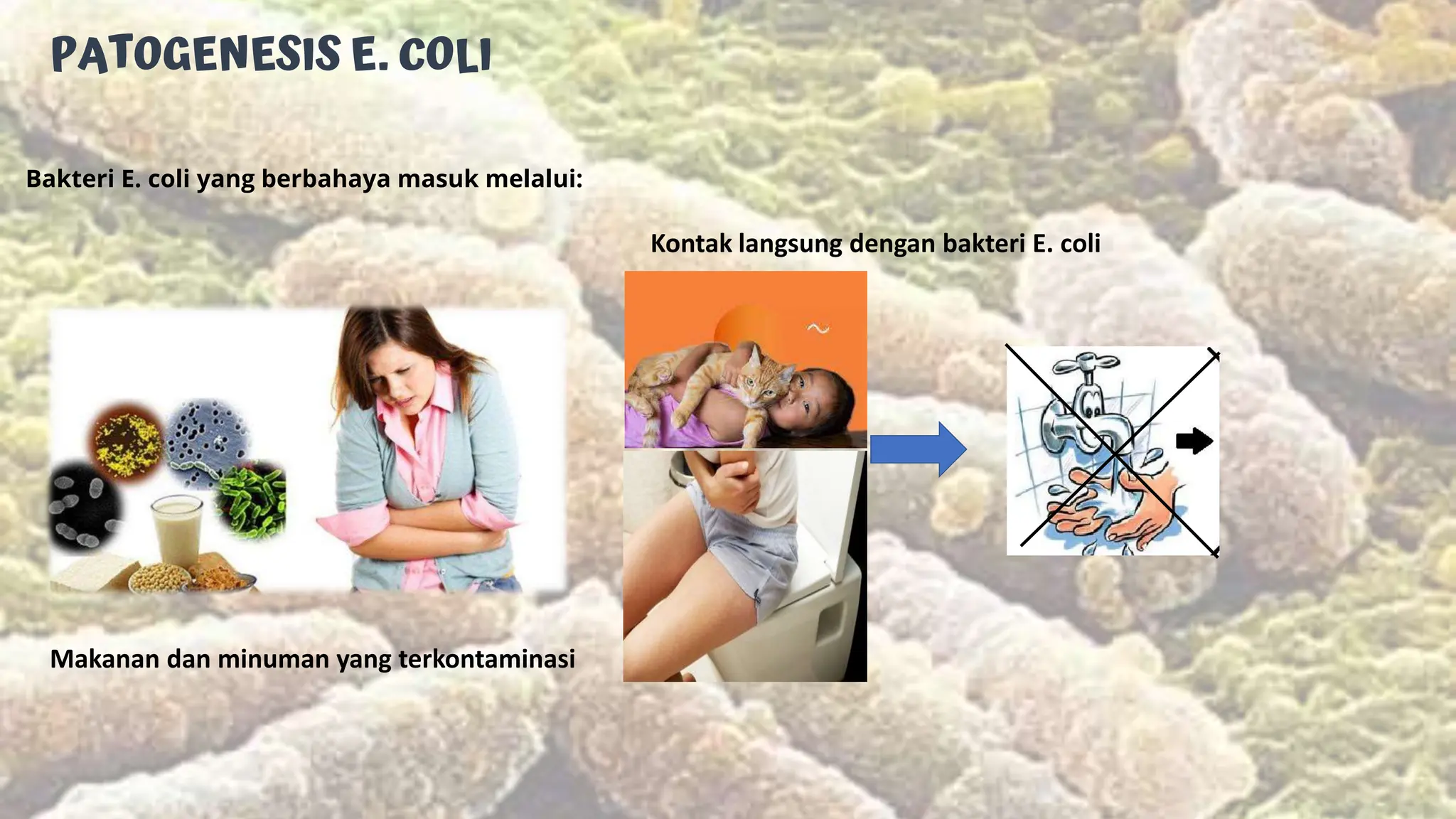 bakteri e. coli escherichia coli dengan Gastroesophageal reflux disease | PPTX