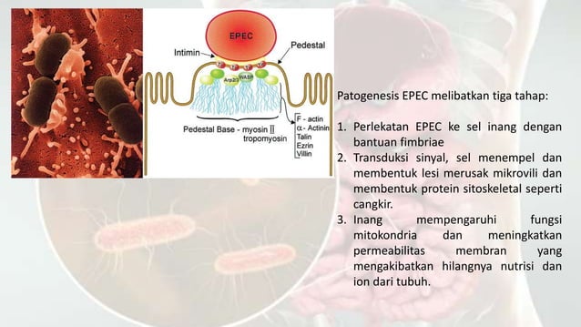 bakteri e. coli escherichia coli dengan Gastroesophageal reflux disease | PPTX