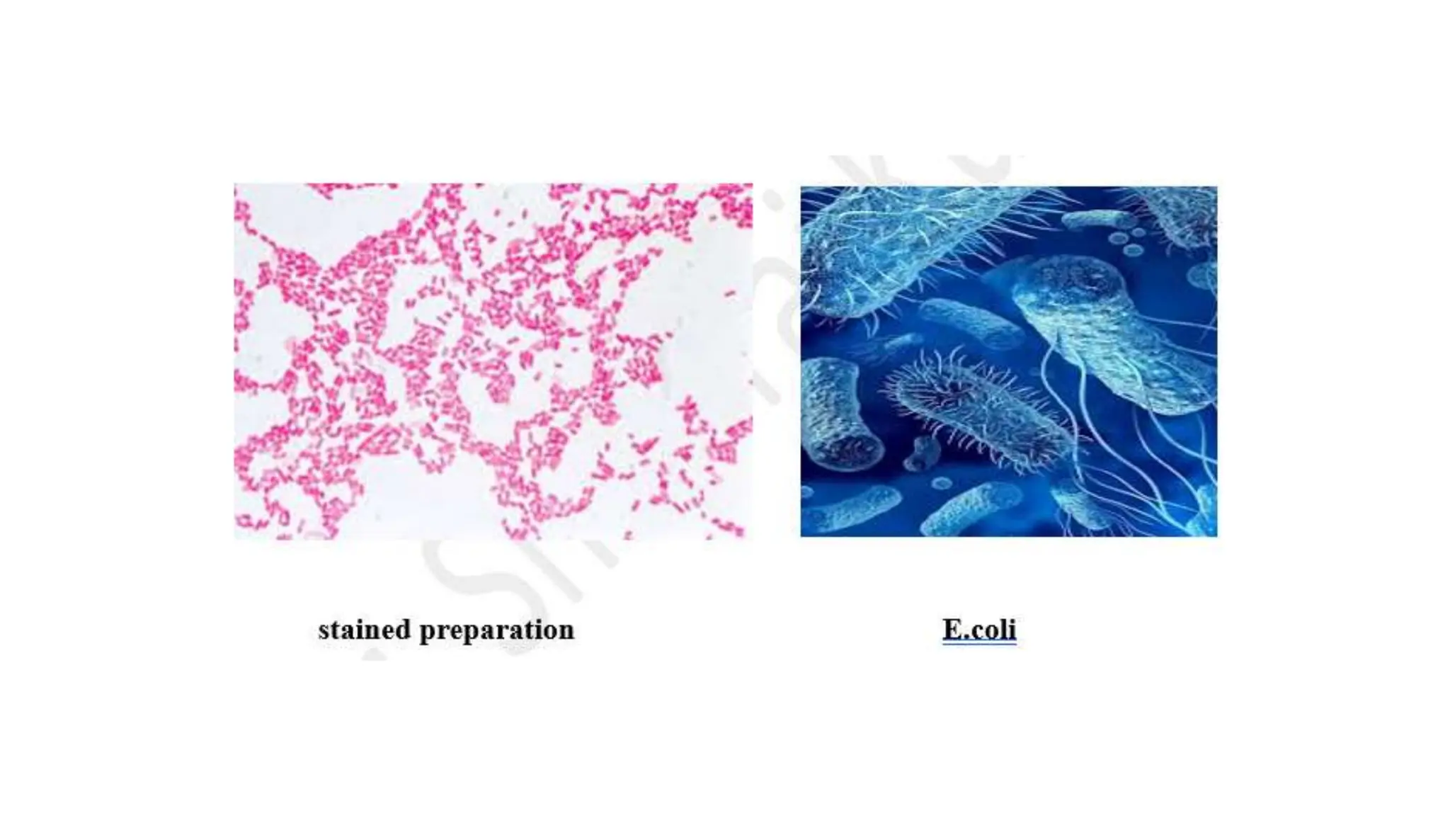 Escherichia Coli ppt for nursing students | PPTX