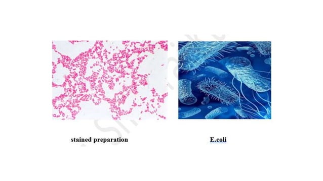 Escherichia Coli ppt for nursing students | PPTX