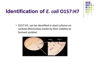 E. Coli of clinical importance medical microbiology | PPT