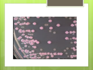 E.coli.pdf bacteria classification various | PDF