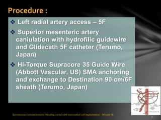E-case01 Misztal aimradial20170921 Intramesenteric coil implantation | PPT