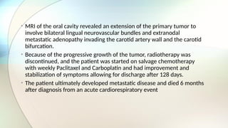 E-CIAGRETTES_AND_ORAL_CANCER[1][1] oral surgery | PPTX