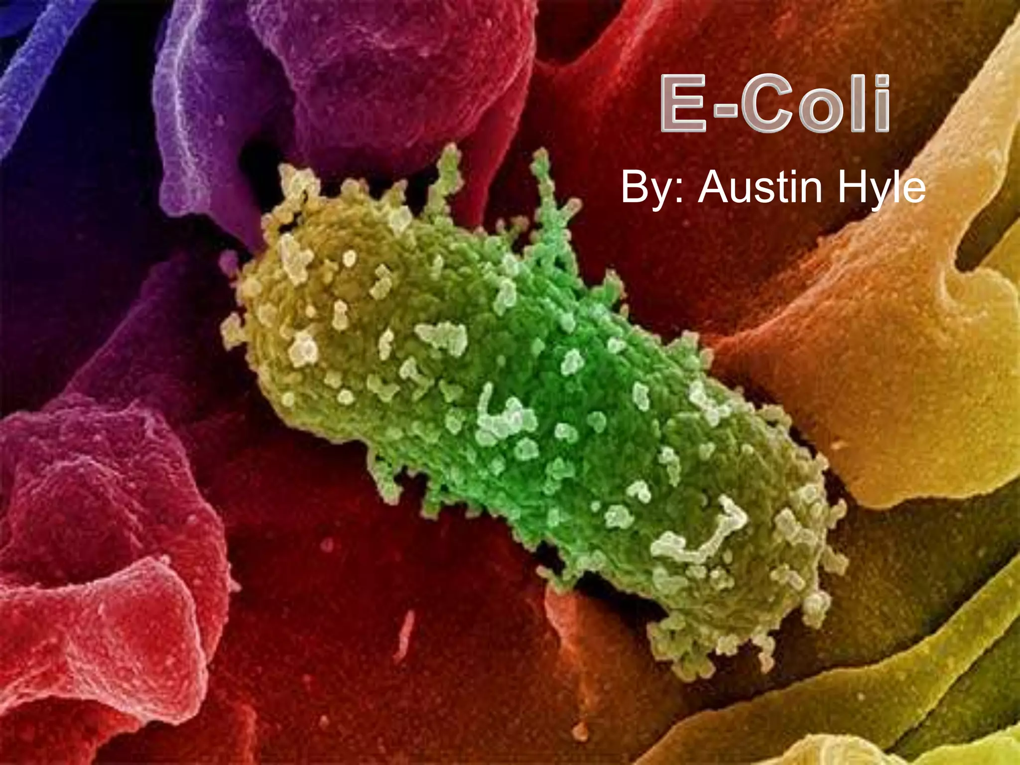 E-Coli.ppt