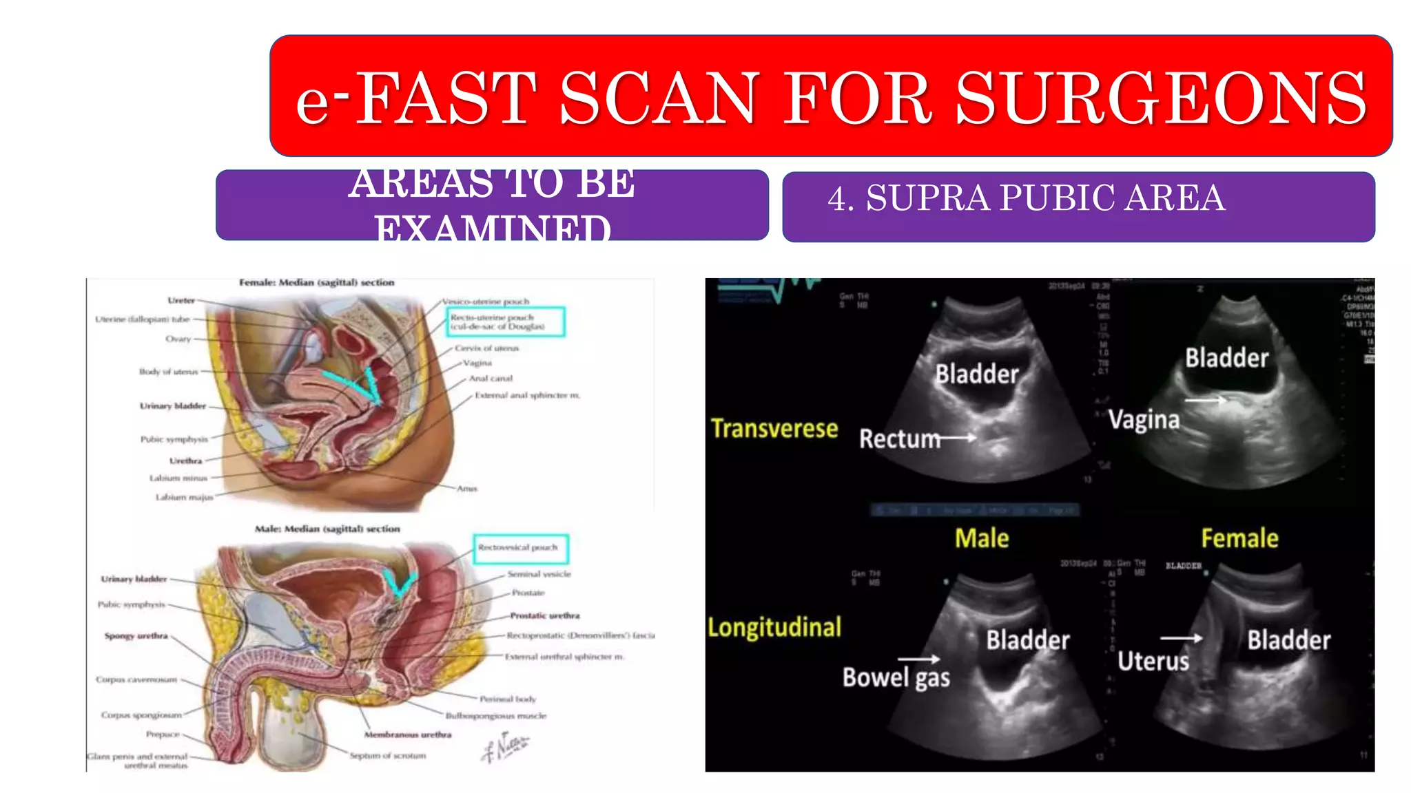 E fast scan for surgeons- skill lab procedure- osce - copy | PPTX
