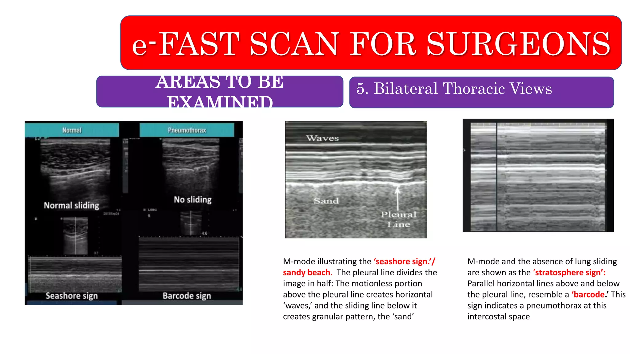 E fast scan for surgeons- skill lab procedure- osce - copy | PPTX