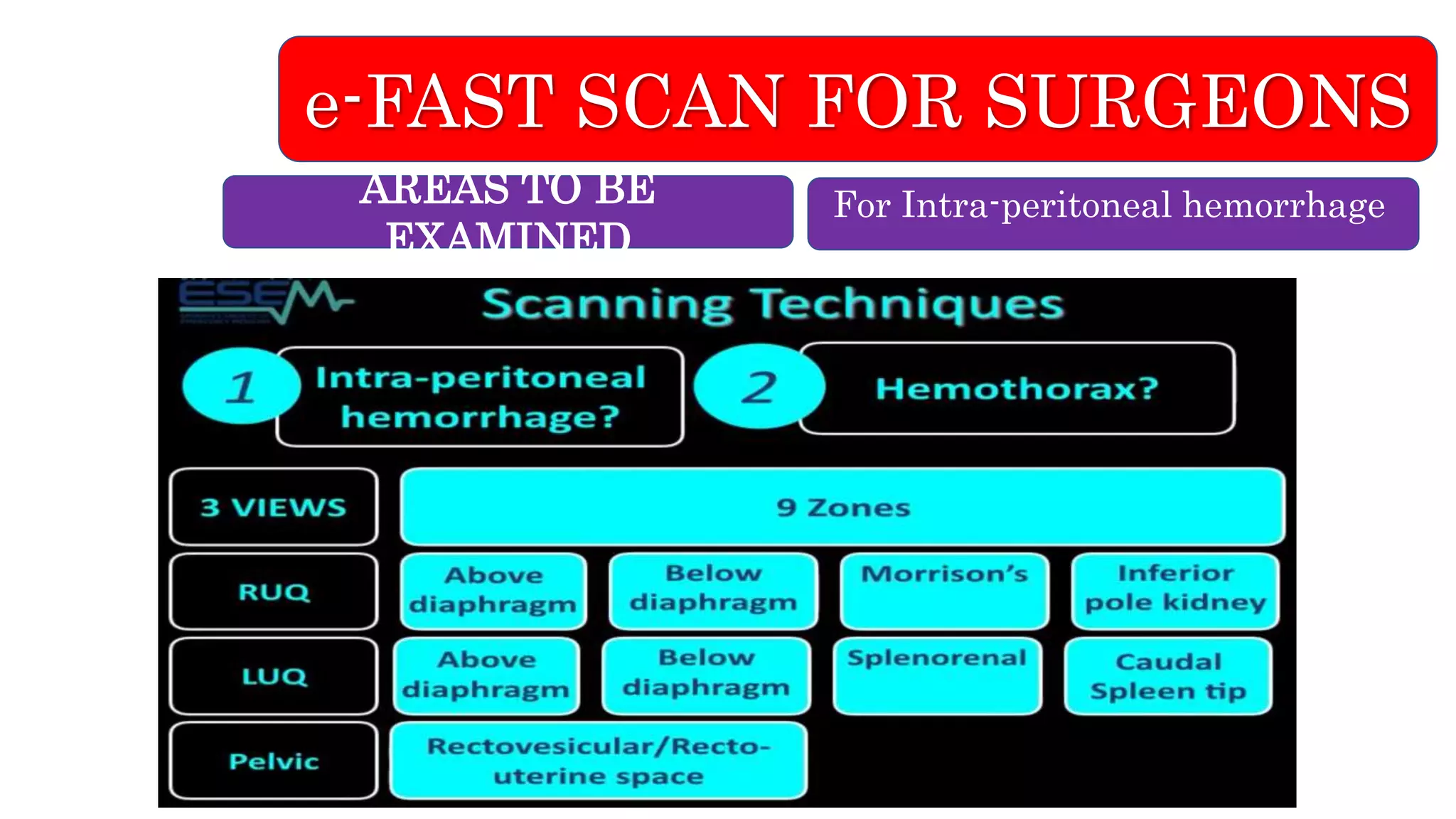 E fast scan for surgeons- skill lab procedure- osce - copy | PPTX