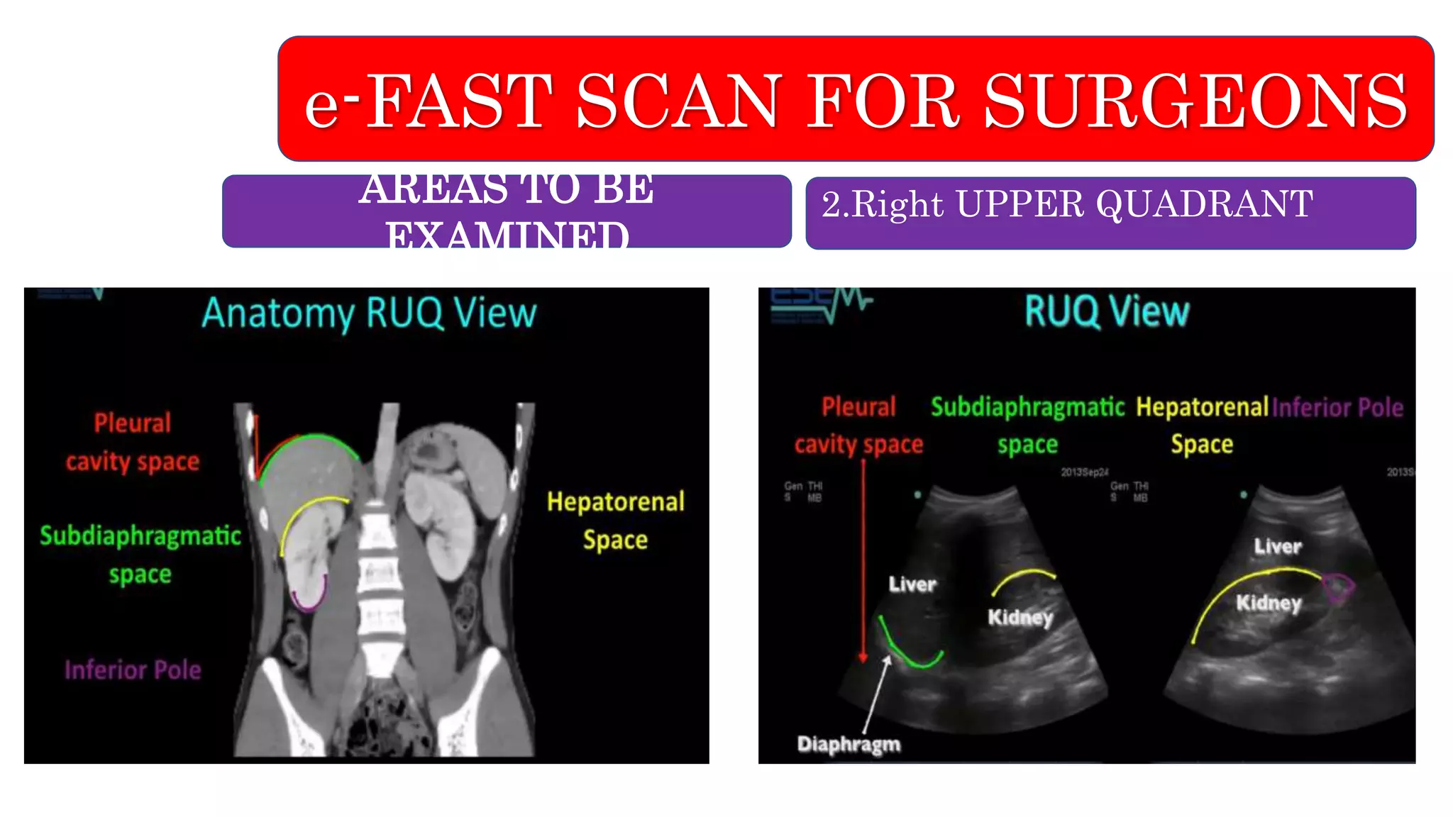 E fast scan for surgeons- skill lab procedure- osce - copy | PPTX