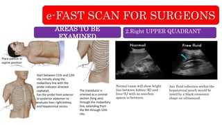 E fast scan for surgeons- skill lab procedure- osce - copy | PPTX