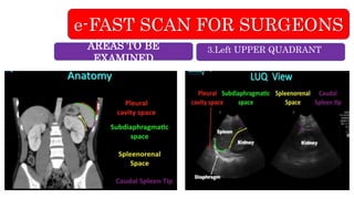 E fast scan for surgeons- skill lab procedure- osce - copy | PPT