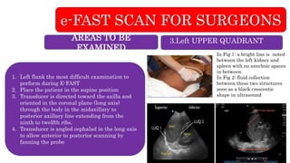 E fast scan for surgeons- skill lab procedure- osce - copy | PPT