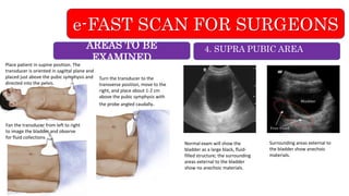 E fast scan for surgeons- skill lab procedure- osce - copy | PPT
