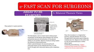 E fast scan for surgeons- skill lab procedure- osce - copy | PPT
