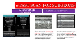 E fast scan for surgeons- skill lab procedure- osce - copy | PPT