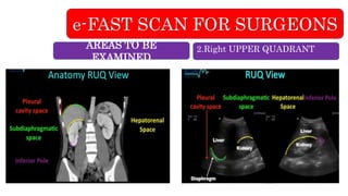 E fast scan for surgeons- skill lab procedure- osce - copy | PPTX