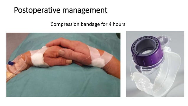 E-poster07 Ruzsa aimradial20170921 Snuff box access | PPT