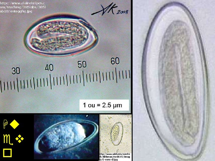 Enterobius Vermicularis