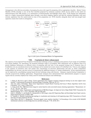 An Approach for Study and Analysis of Brain Tumor Using Soft Approach | PDF