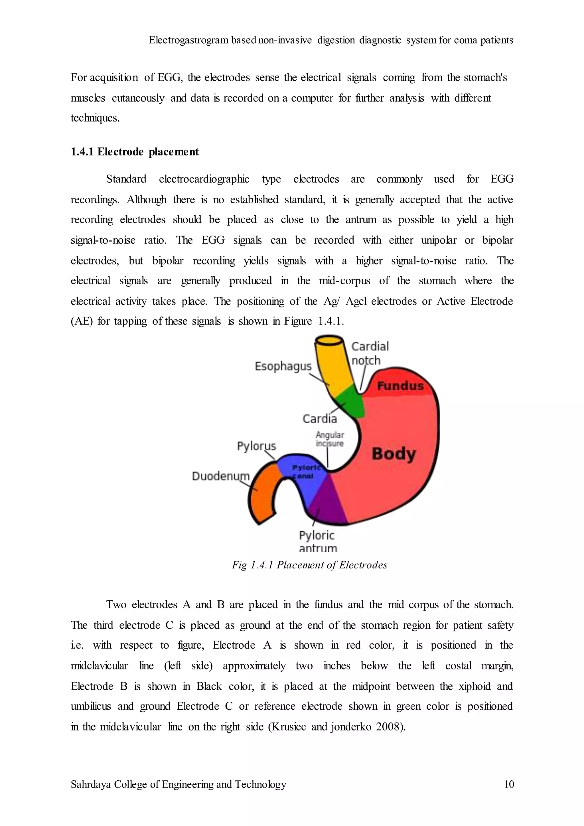 Electrogastrogram based digestion detection system for coma patients | DOCX
